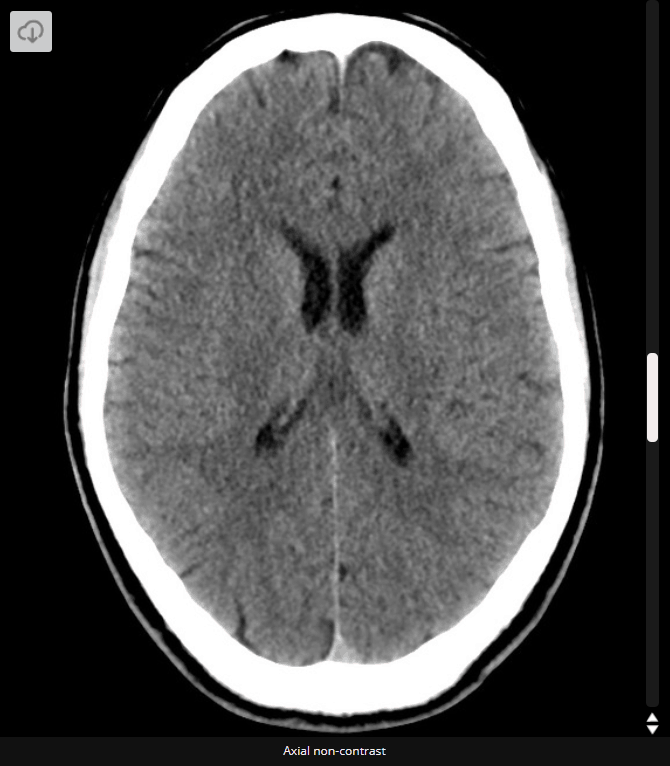 Was ist der Unterschied zwischen einer CT und cCT?